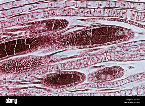 Antheridia Of Mnium Hi Res Stock Photography And Images Alamy
