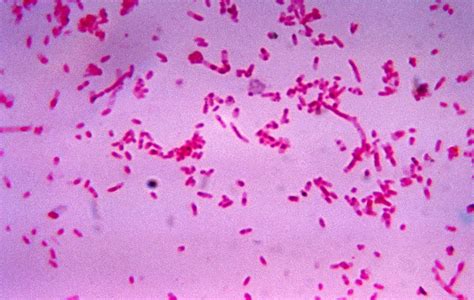 Gram Negative Bacilli Rods Microbiology Learning The Whyology Of