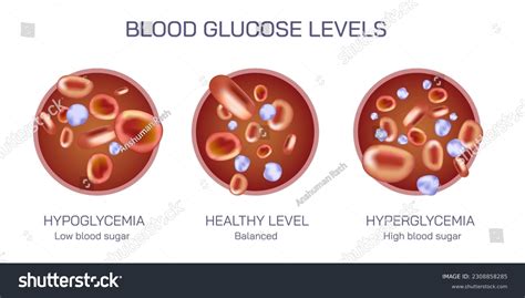 Blood Glucose Levels Vector Illustration High Stock Vector Royalty