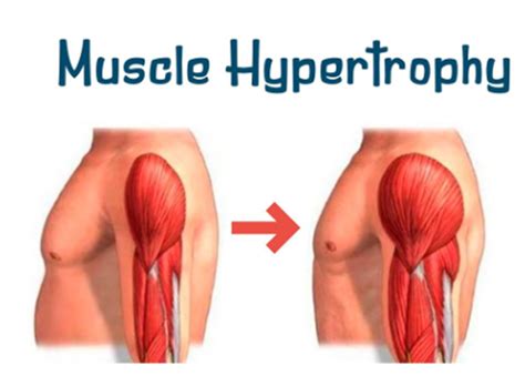 Hypertrophy Definition And Examples Biology Online Dictionary
