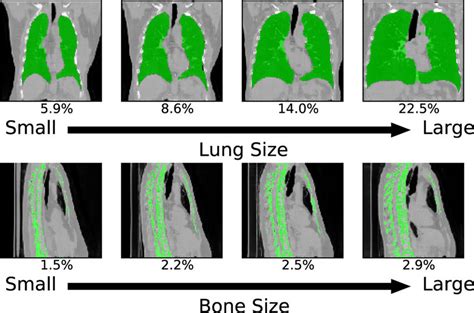 Latent Space Exploration On Thorax Ct Images The Figure Reports Download Scientific Diagram