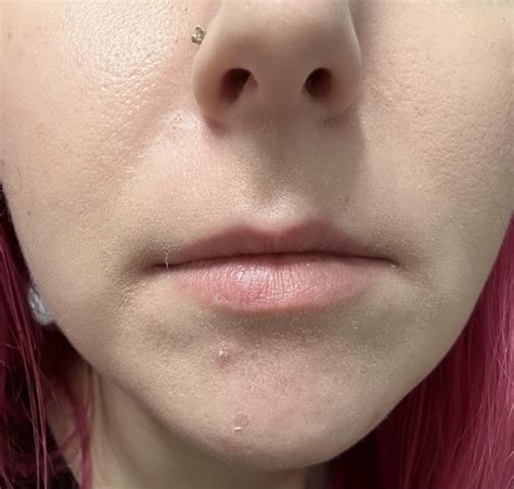 Does This Look Like Makeup Separation Or A Skin Prep Issue R