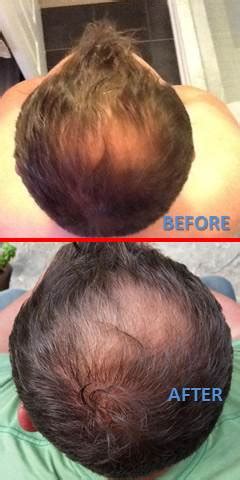 Nioxin Hair Care For Thinning Hair Review Mommy Gearest