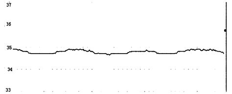 Early Warning Method For Generator Overheating Fault Hidden Danger Based On Three Dimensional