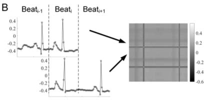 Dual Beat Coupling Matrix Computed From Two Pairs Of Adjacent Beats A Download Scientific