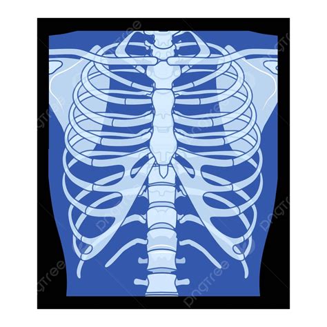 Realistic Front View Of Human Rib Cage Xray Vector Medical Bone Chest Png And Vector With