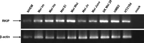 amplification of the complete coding region of rkip mrna by pcr the