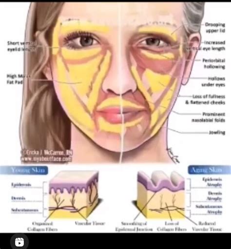 Pin By Nicole Suchy On Skin Deep Facial Aesthetics Facial Anatomy