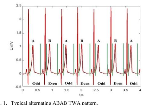 Figure 2 From Evaluation Of Machine Learning Techniques For Ecg T Wave Alternans Semantic Scholar