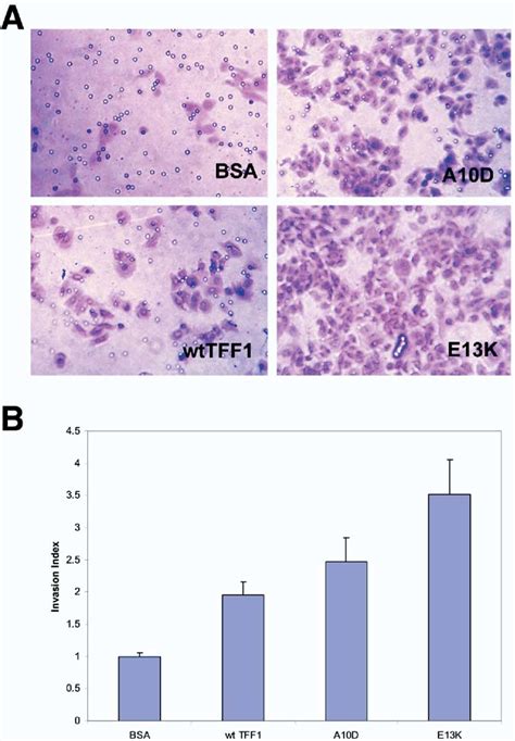 Invasion Of Ags Cells In Response To Wttff1 And Mutant Tff1 Proteins Download Scientific