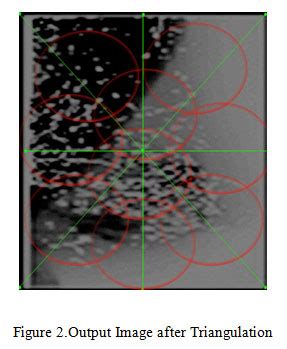 Euclidean Distance Transform EDT Algorithm Applied To Binary Image For Finding Breast Cancer