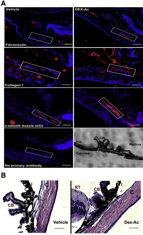 Dex Ac Treatment Increases Expression Of Fibronectin Collagen I And
