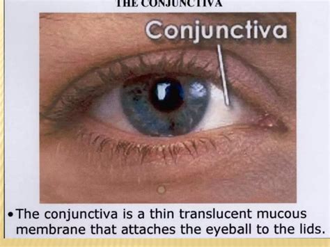 4 Conjunctival Disorders Oghre Pptx