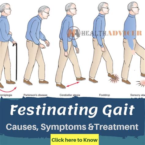 Festinating Gait Causes Picture Symptoms And Treatment
