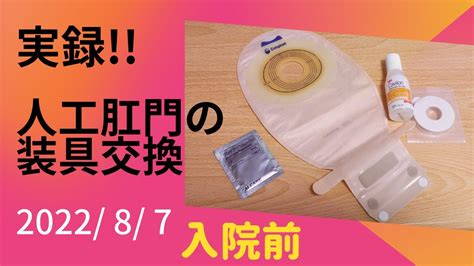実録人工肛門 ストーマ の装具交換 2022 8 7入院前 センシュラ1プロケアーソフトウエハーリング YouTube