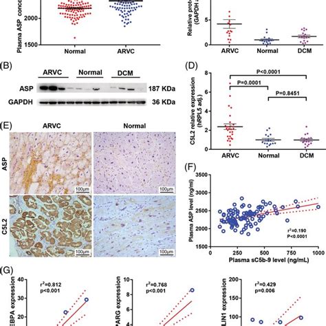 elevated asp‐c5l2 pathway in patients with arvc a plasma asp levels
