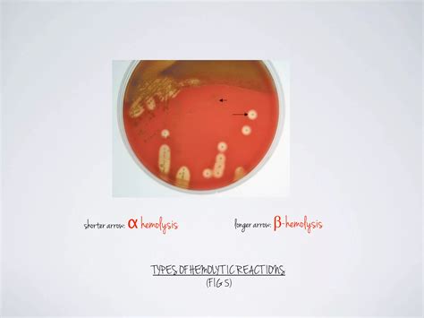 Streptococcus Mutans And Other Streptococci Pdf