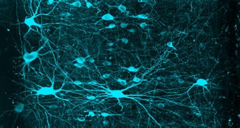 RNA Seq Reveals How The Brain Tells Our Limbs Apart RNA Seq Blog