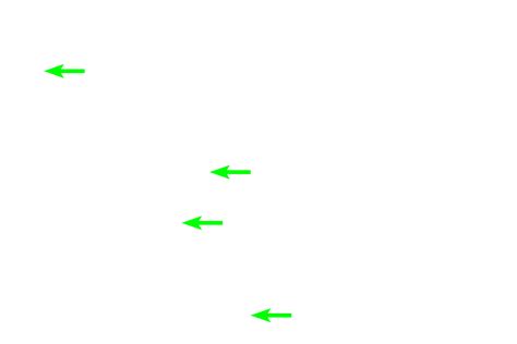 Tubules And Collecting System Digital Histology