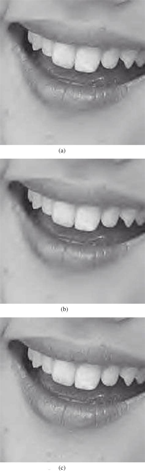 Subjective Comparison Of The Woman Image Encoded At 025 Bppa Spiht Download Scientific