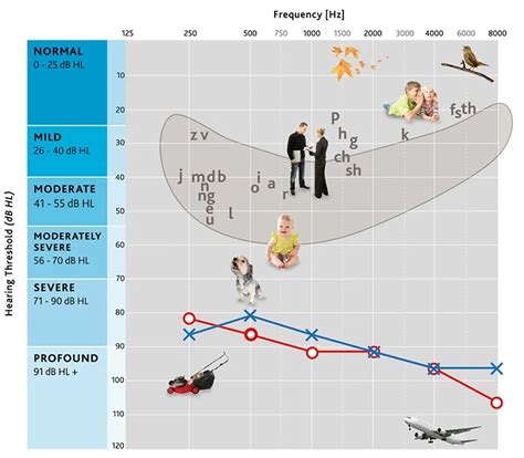 Degrees Of Hearing Loss — Hearing Health Foundation