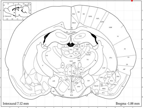 Investigated Two Areas In The Somatosensory Cortex The Secondary