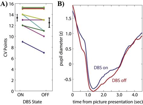 Subthalamic Nuclei Deep Brain Stimulation Improves Color Vision In Patients With Parkinsons