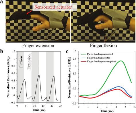 Application Of The Sensorized Actuator As A Finger Rehabilitation Download Scientific Diagram