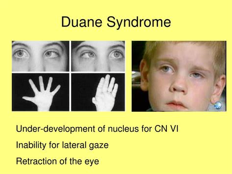 Ppt Vision Screening Part I Eye Pathology Powerpoint Presentation