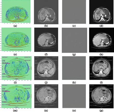 Least Square Based Prediction Lossless Compression Outputs A P Id1 Id4 Download Scientific