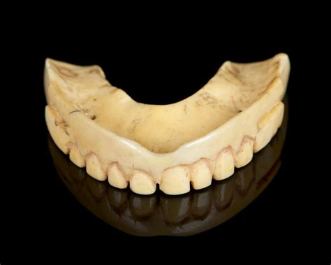Full Upper Denture Science Museum Group Collection
