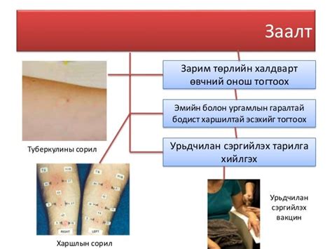 Арьсан доторх тарилга