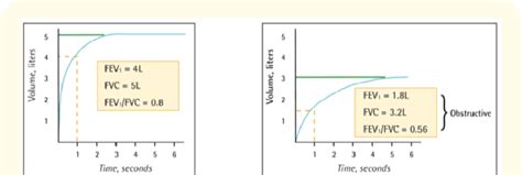 Left Figure Shows A Normal Spirometry Patient Has A FVC Of 5 Liters Download Scientific