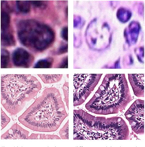 Figure 1 From A Comprehensive Overview Of Computational Nuclei Segmentation Methods In Digital