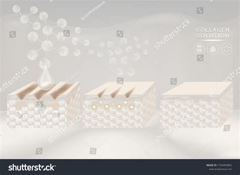 피부 용액광고 전후에 발루로닉산 흰색 콜라겐 스톡 벡터 로열티 프리 1754404862 Shutterstock