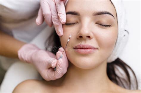 Face Lifting Pdo Suture Operation Innovative Technique Of New Thread