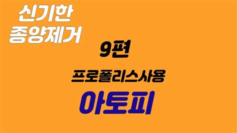 신기한 종양제거 제9편 프로폴리스를 사용한 아토피치료법 Youtube