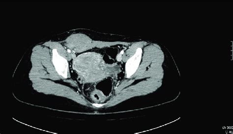 Preoperative Imaging Examination Download Scientific Diagram