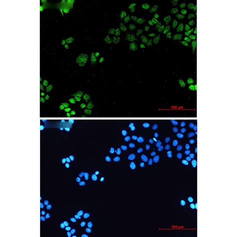 Tata Box Binding Protein Rabbit Mab Wb Ihc P Ihc F Ip Icc Buy Now