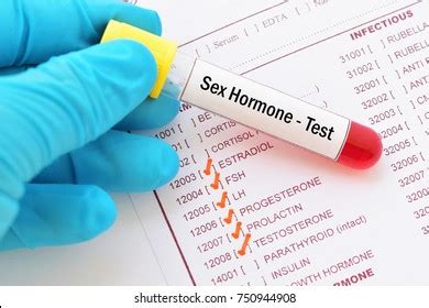 Blood Sample Requisition Form Sex Hormone Stock Photo 750944908