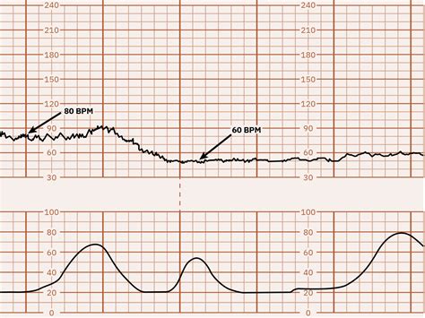 10 5 Fetal Heart Rate Monitoring Nursing Health Promotion
