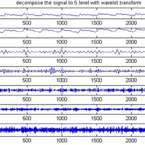 Continuous Icp Signal Decomposed With The First Generation Wavelet Download Scientific Diagram