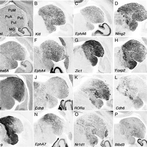 Gene Expression In Connecting Regions To The Prefrontal Download Scientific Diagram