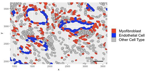 Spatial Transcriptomic Analysis Reveals Vascular Zonation Of