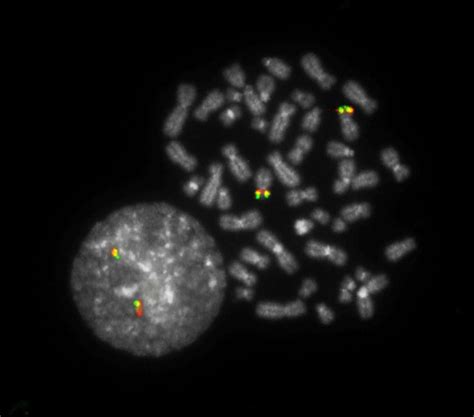 Xl Etv6 Break Apart Probe Metasystems Probes