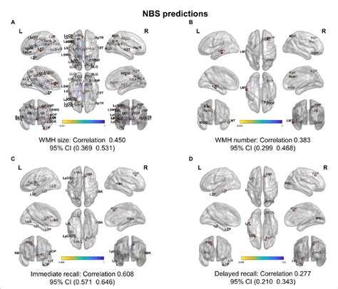 Nbs Classification In Patients With Sacs The Nbs Classification Download Scientific Diagram