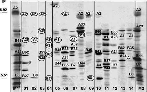 Analysis Of Hla A B Gene Products In Malignant Melanoma Lesions Download Scientific Diagram