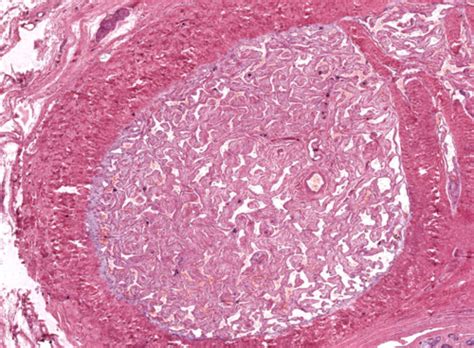 Histology Of Reproductive Structures Flashcards Quizlet