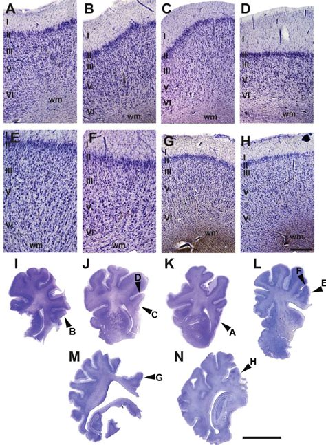 Cytoarchitecture Of The Subgenual A Pregenual B Ventral Download Scientific Diagram