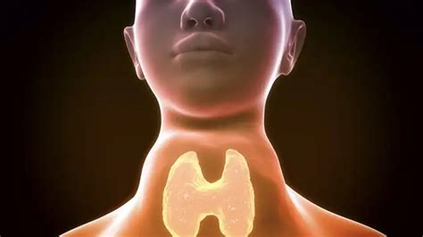 Graves Disease Diffuse Toxic Goiter Treatment